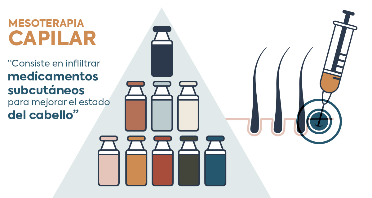 Diferencia entre mesoterapia capilar y PRP