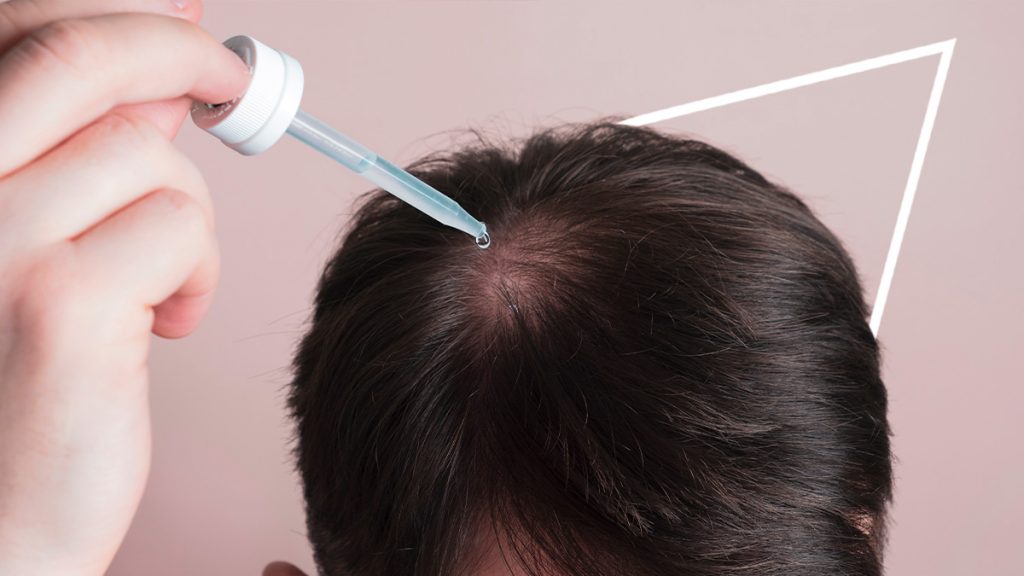 Minoxidil. Barba. Precio. Cómo usar. Para qué sirve. 5% y 2%